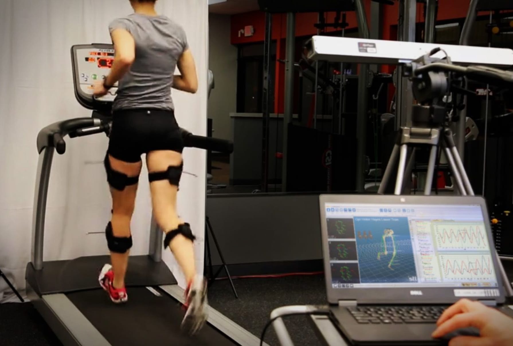 Why Understanding the Gait Cycle is Crucial for Your Health - RunDNA