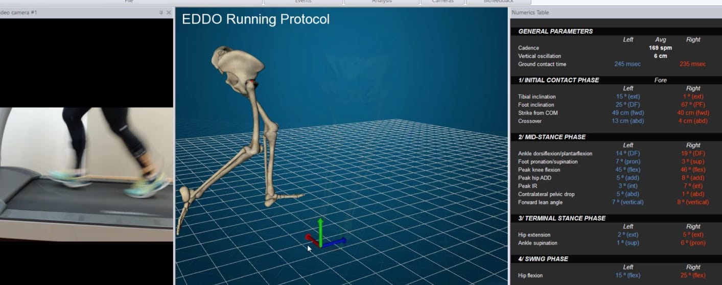 How Do You Check Your Running Gait? - RunDNA